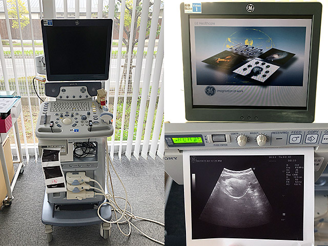 Ultrasound LOGIQ P6 GE | Used Medical Equipment Supplier in Japan ...